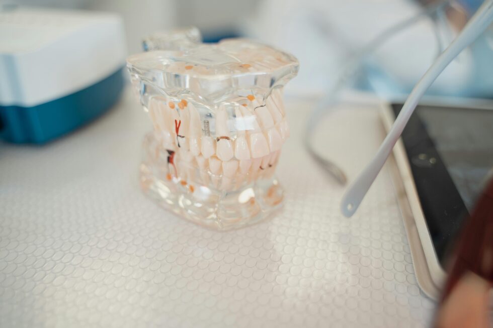 Are Dental Implants Worth It? Absolutely - Pacific Dental & Implant ...